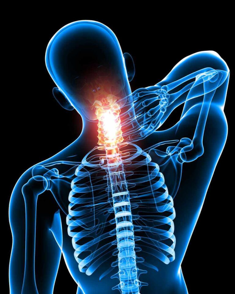 Neck Pain Relief and Treatment - Vitalign Spine Clinic